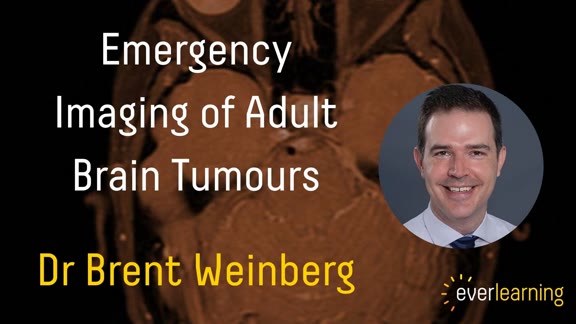 everlearning Webinars - Neuroradiology and Head & Neck Webinars