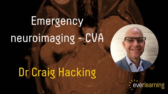 everlearning Webinars - Neuroradiology and Head & Neck Webinars